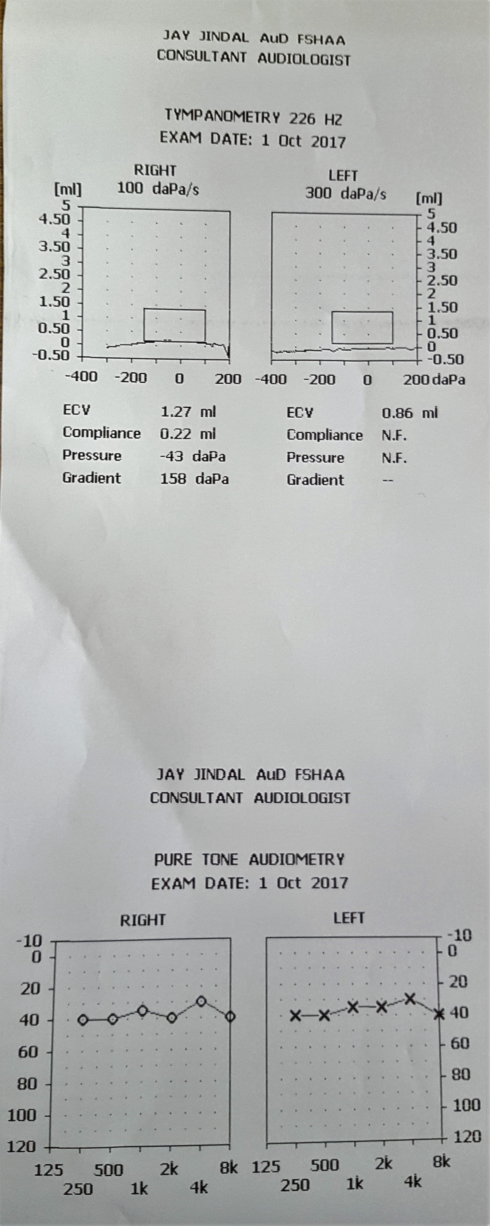 Review of Inventis Viola-Combi Audiometer and Tympanometer